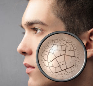 Chapped Skin – Corium 21